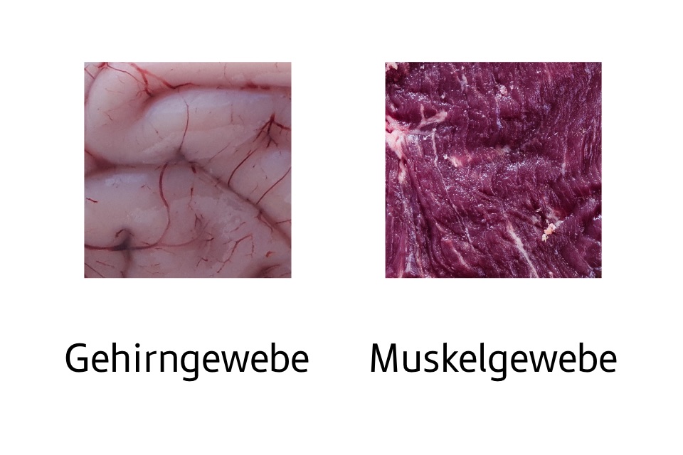 Blick ins Innere des menschlichen Körpers | Biologie | SchuBu